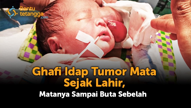 Bantu Tetangga - Platform Penggalangan Dana Online